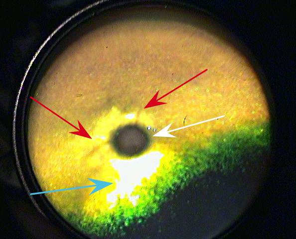 Image Gallery: Feline Fundus Diseases | Clinician's Brief