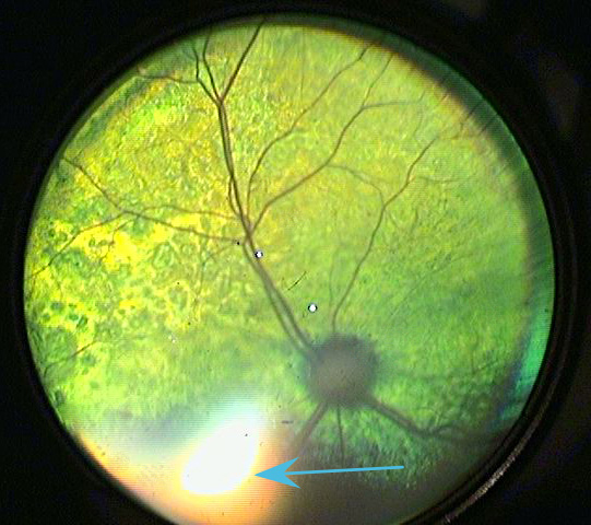 Image Gallery: Feline Fundus Diseases | Clinician's Brief