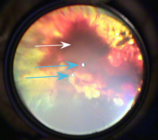 Image Gallery: Feline Fundus Diseases | Clinician's Brief