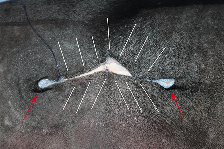 Image Gallery: Surgical Tension Lines | Clinician's Brief
