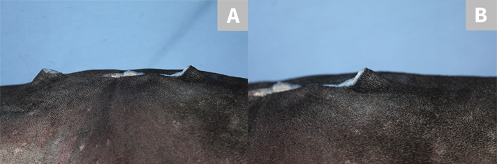 Image Gallery: Surgical Tension Lines | Clinician's Brief