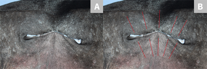 Image Gallery: Surgical Tension Lines | Clinician's Brief