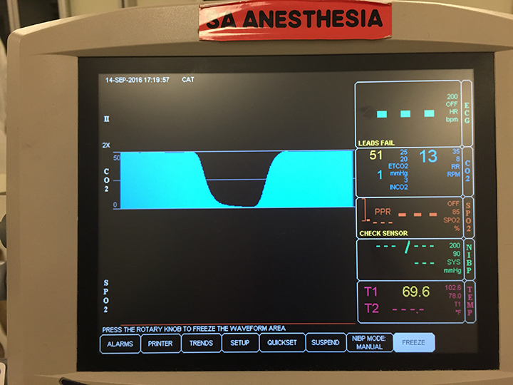 Image Gallery: Capnography | Clinician's Brief