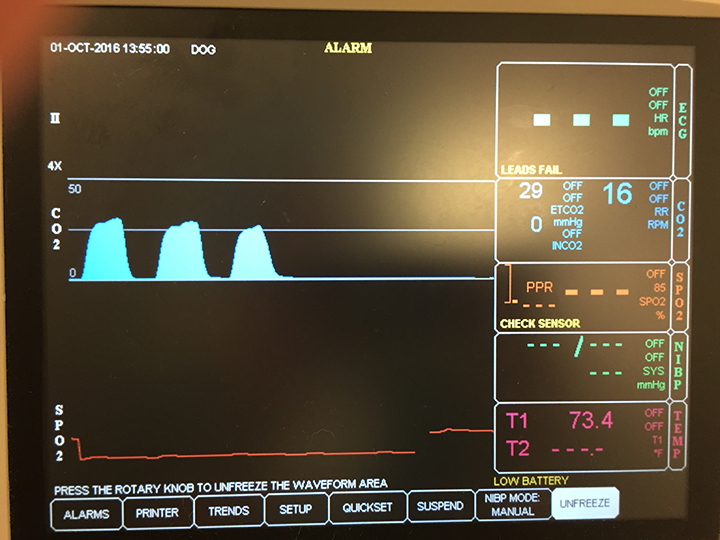 Image Gallery: Capnography | Clinician's Brief