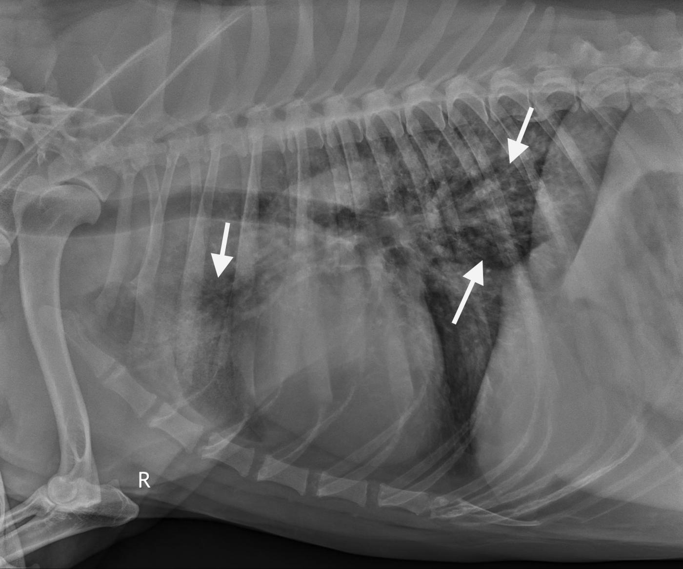 Image Gallery: Primary & Metastatic Tumors Part 1 | Clinician's Brief