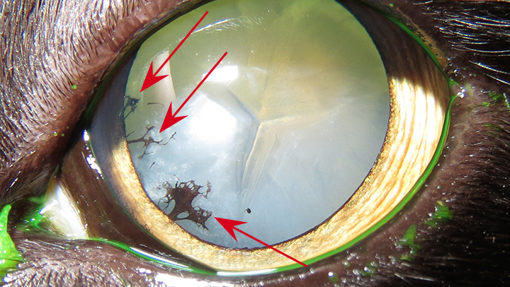 Image Quiz: Nuclear Sclerosis or Cataract? | Clinician's Brief