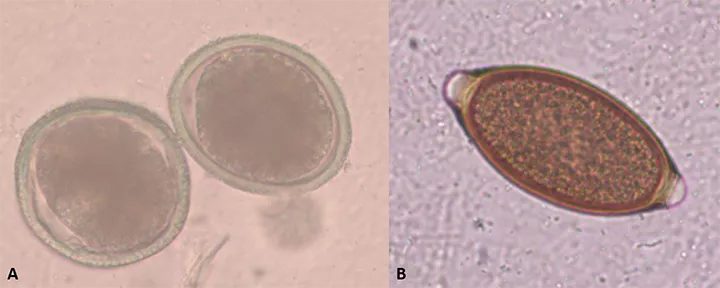 Parasite Risk in Dog Parks | Clinician's Brief