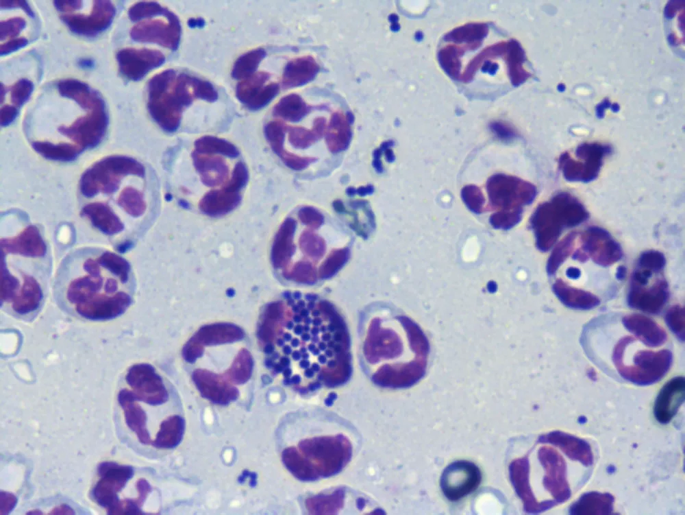 The Red, Itchy Ear: A Case Study of Canine Otitis Externa | Clinician's ...