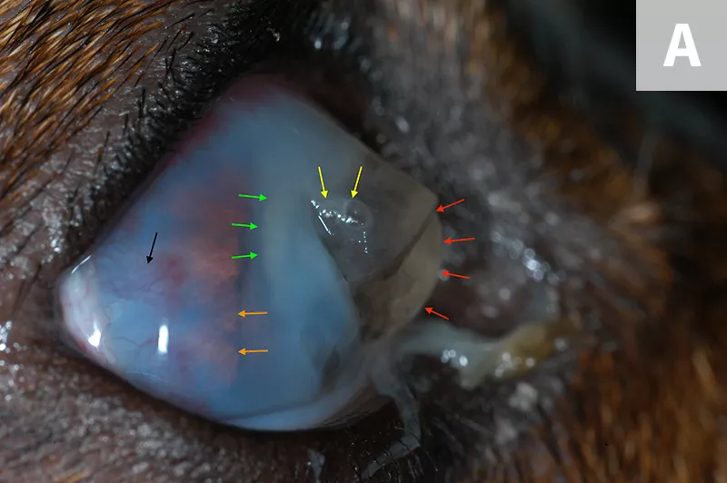 Image Gallery: Corneal Perforations Do Not All Look the Same ...