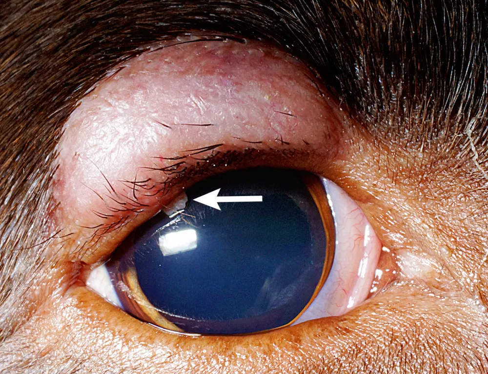 Image Gallery: Canine Eyelid Diseases | Clinician's Brief